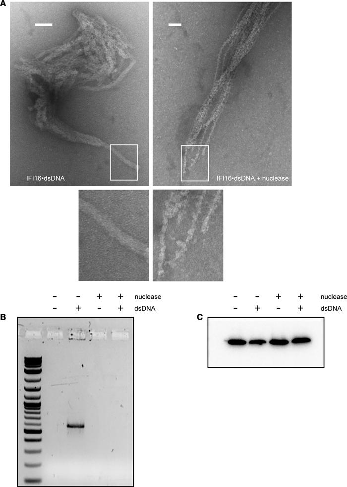 JCI Insight - IFI16 filament formation in salivary epithelial cells ...