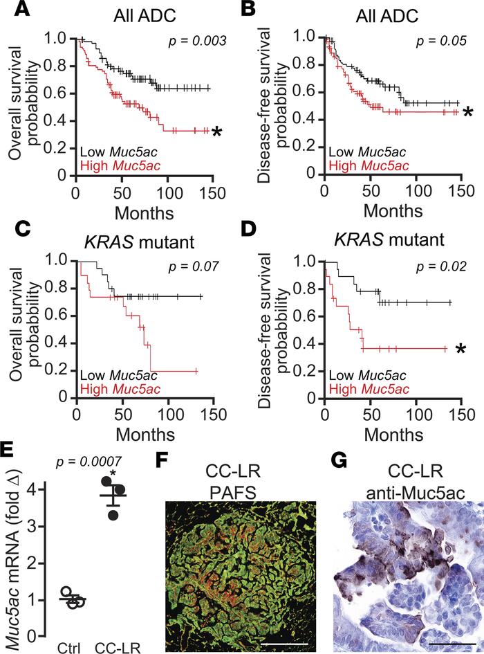 JCI Insight - Requirement for MUC5AC in KRAS-dependent lung carcinogenesis
