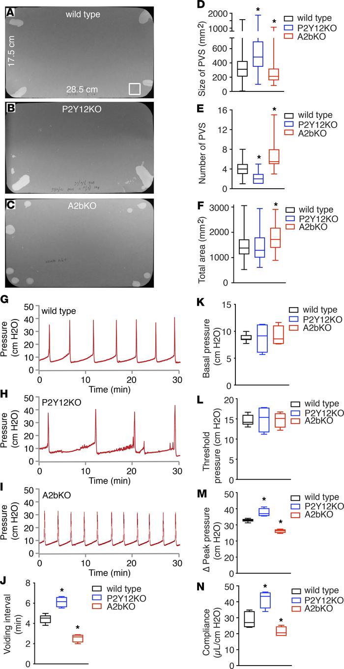 JCI Insight - Targetable purinergic receptors P2Y12 and A2b ...