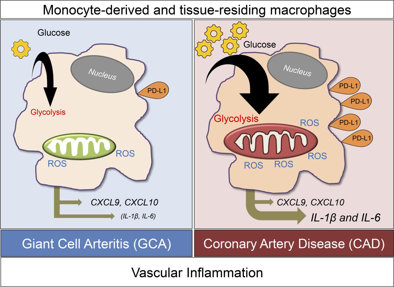 JCI Insight - Glucose metabolism controls disease-specific signatures ...