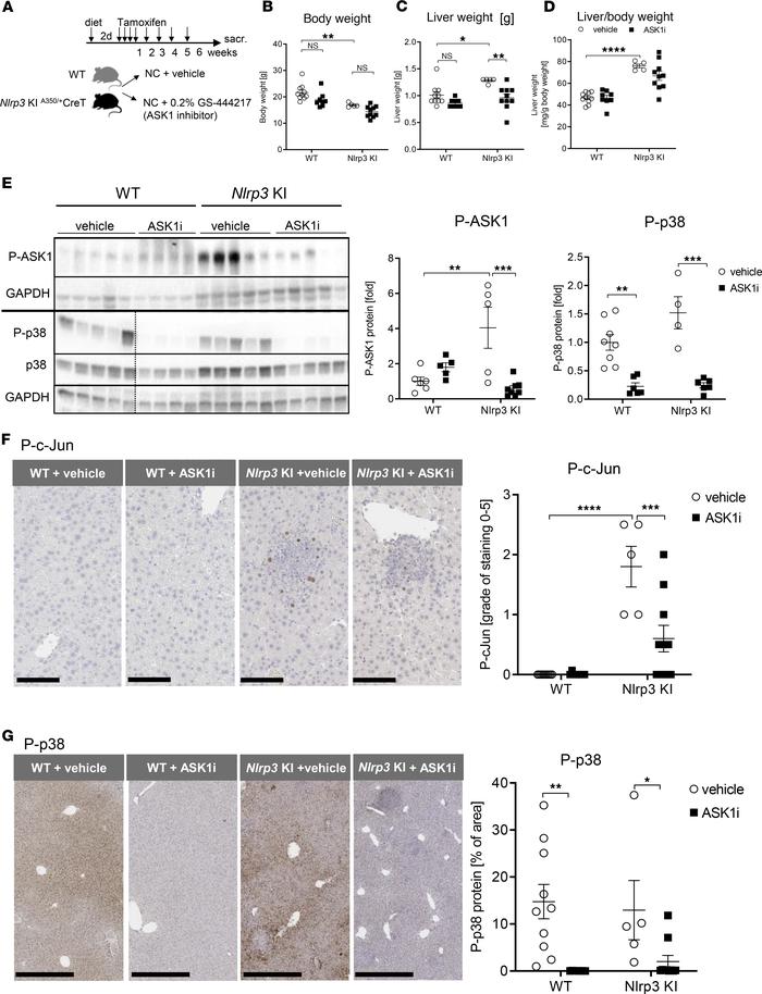 JCI Insight - ASK1 inhibition reduces cell death and hepatic fibrosis ...