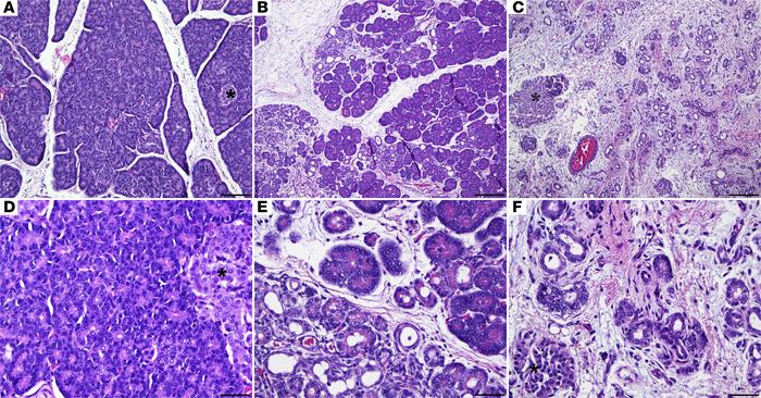 JCI Insight - A sheep model of cystic fibrosis generated by CRISPR/Cas9 ...