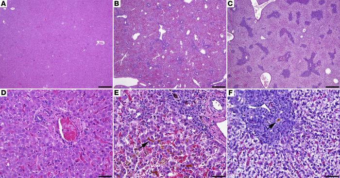 JCI Insight - A sheep model of cystic fibrosis generated by CRISPR/Cas9 ...