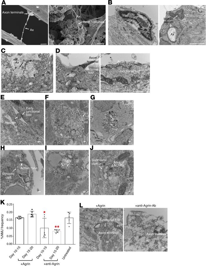 JCI Insight - iPSC-derived functional human neuromuscular junctions ...