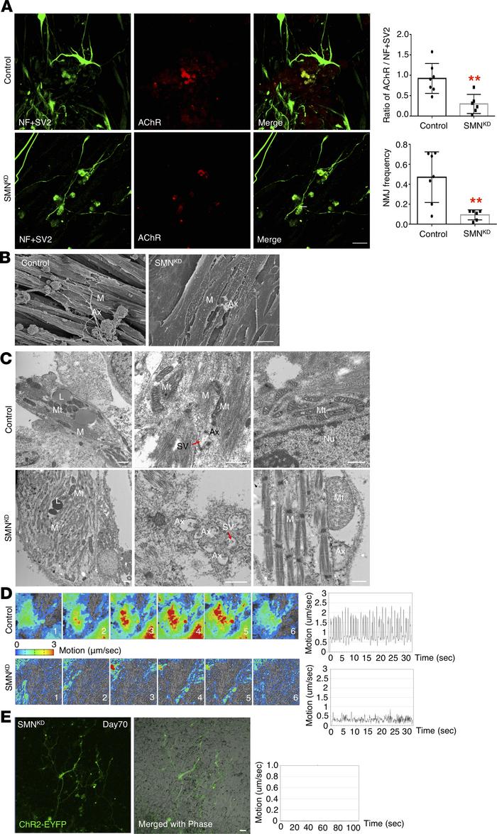 JCI Insight - iPSC-derived functional human neuromuscular junctions ...