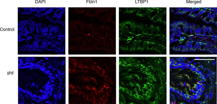 JCI Insight - Fibulin-1c regulates transforming growth factor–β ...