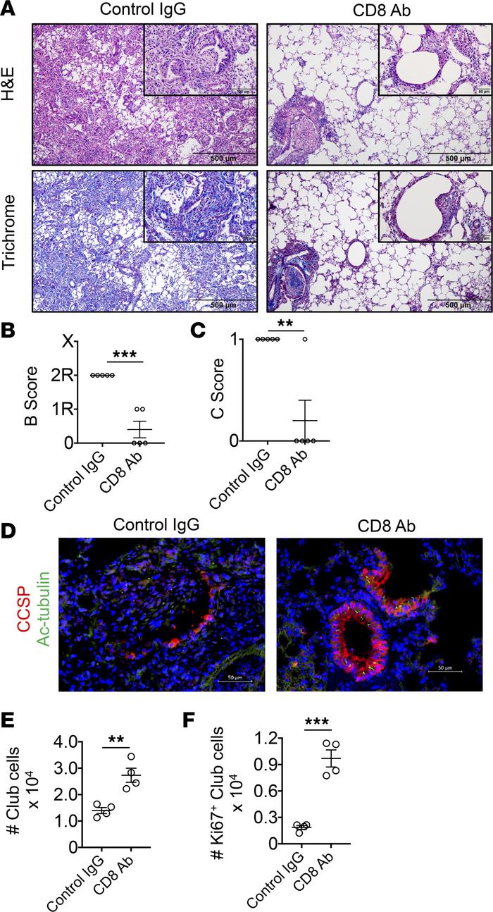 JCI Insight - An obligatory role for club cells in preventing ...