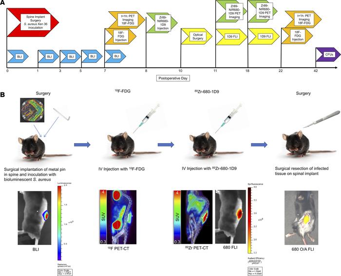 JCI Insight - Multimodal imaging guides surgical management in a ...