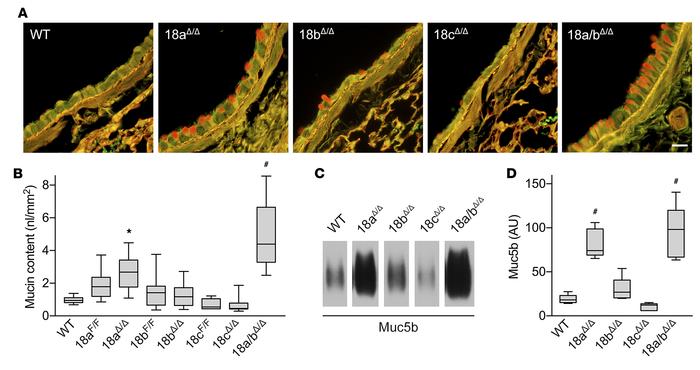 JCI Insight - Different Munc18 proteins mediate baseline and stimulated ...
