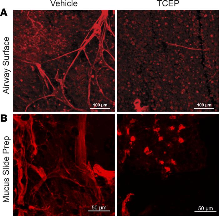 JCI Insight - Mucus strands from submucosal glands initiate mucociliary ...