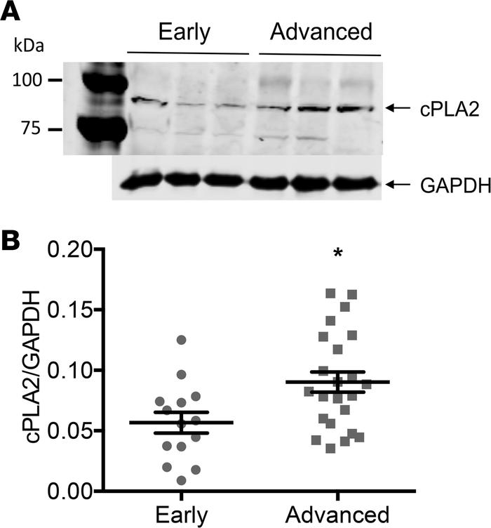 JCI Insight - Systems biology identifies cytosolic PLA2 as a target in ...