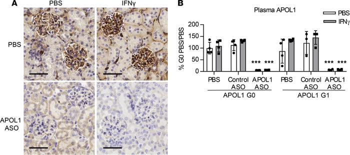 JCI Insight - Antisense oligonucleotide treatment ameliorates IFN-γ ...