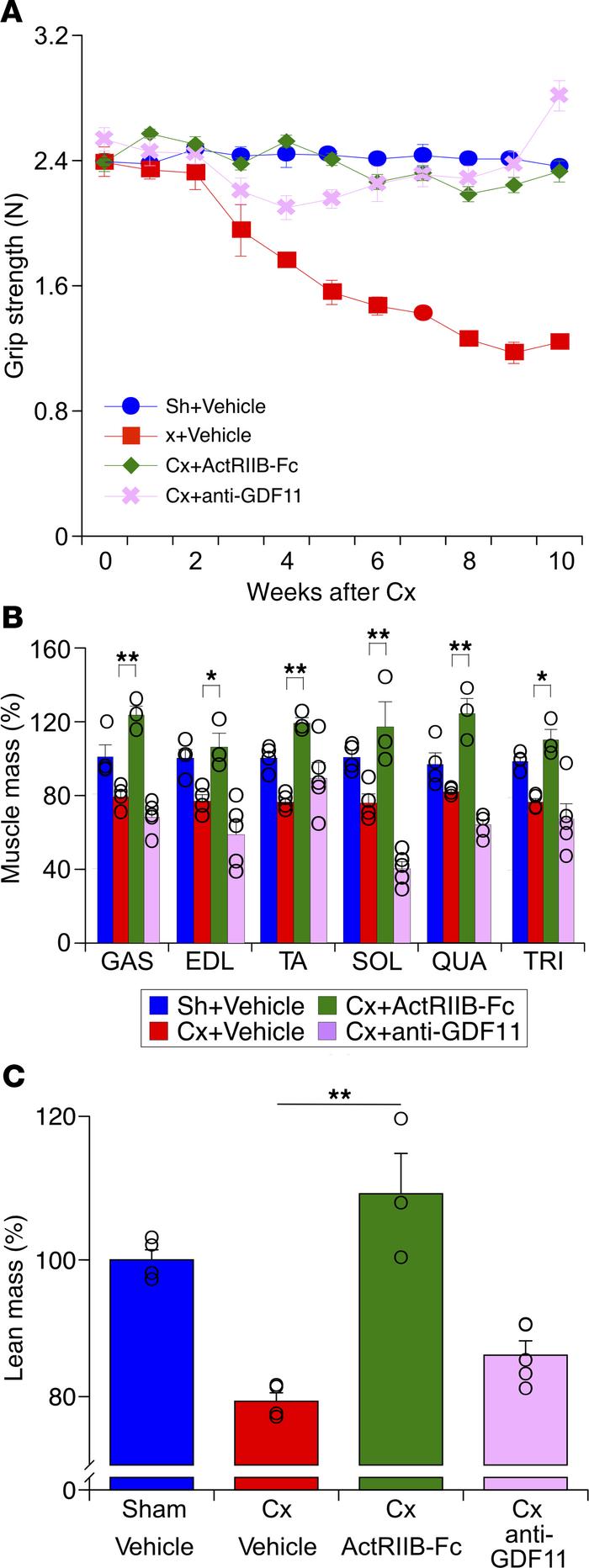 JCI Insight - Prostate tumor–derived GDF11 accelerates androgen ...