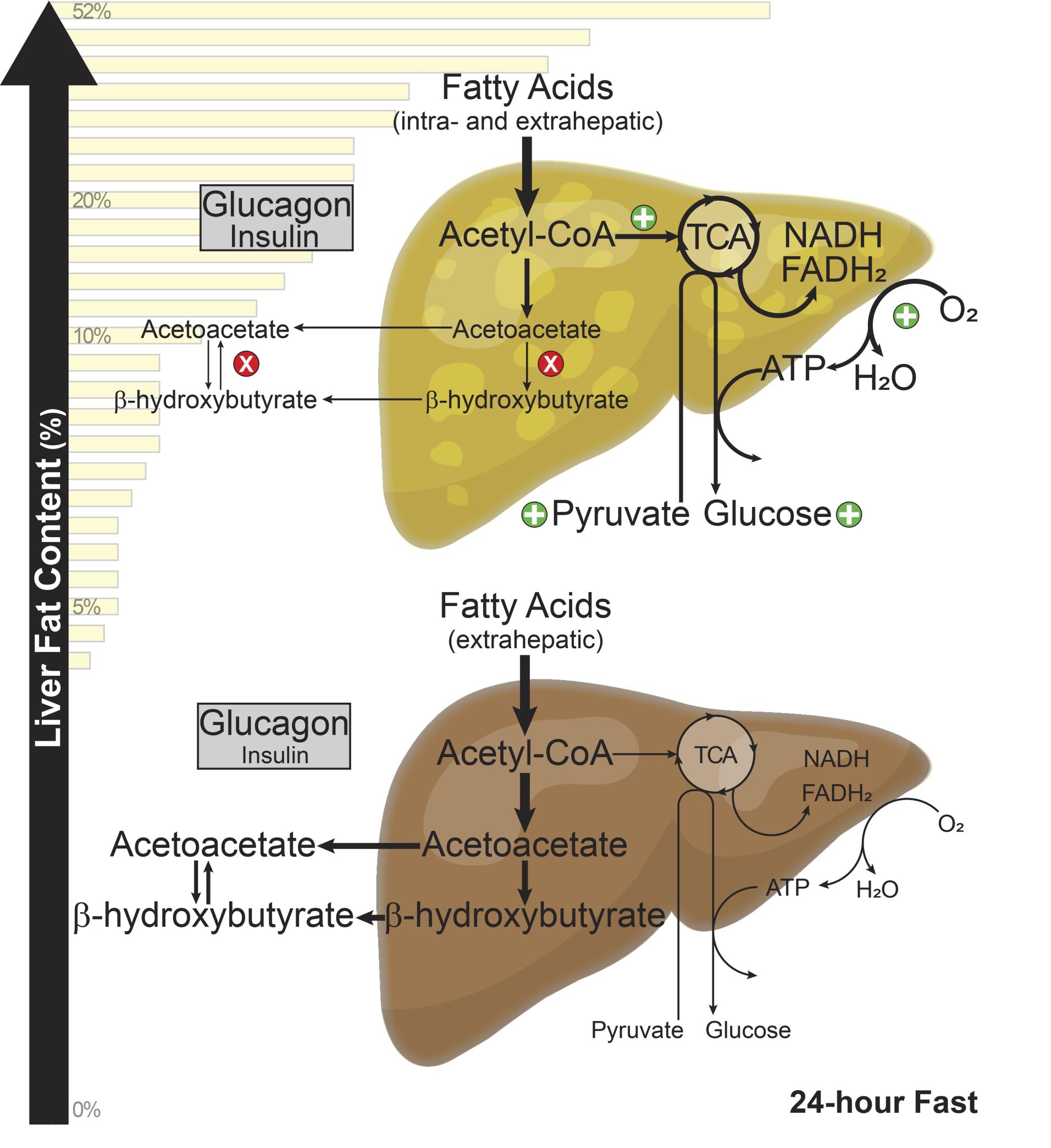 JCI Insight - Impaired ketogenesis and increased acetyl-CoA oxidation ...
