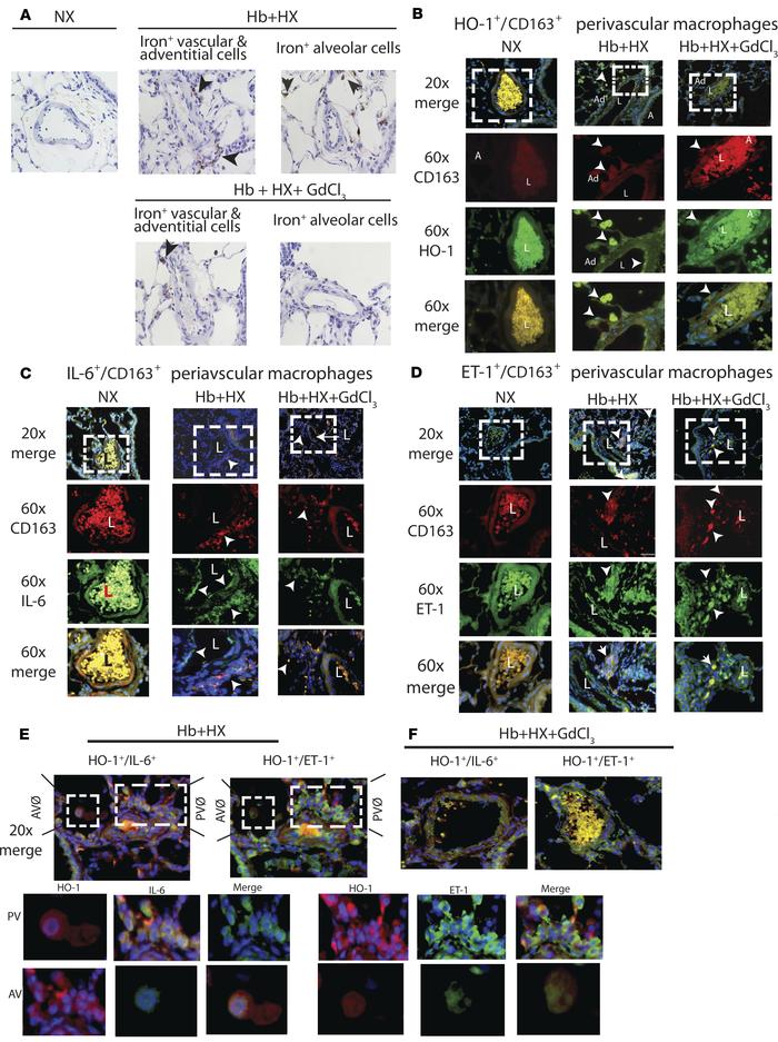 JCI Insight - An Hb-mediated circulating macrophage contributing to ...