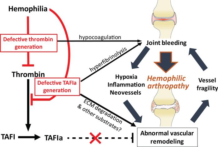 JCI Insight TAFI Deficiency Causes Maladaptive Vascular Remodeling