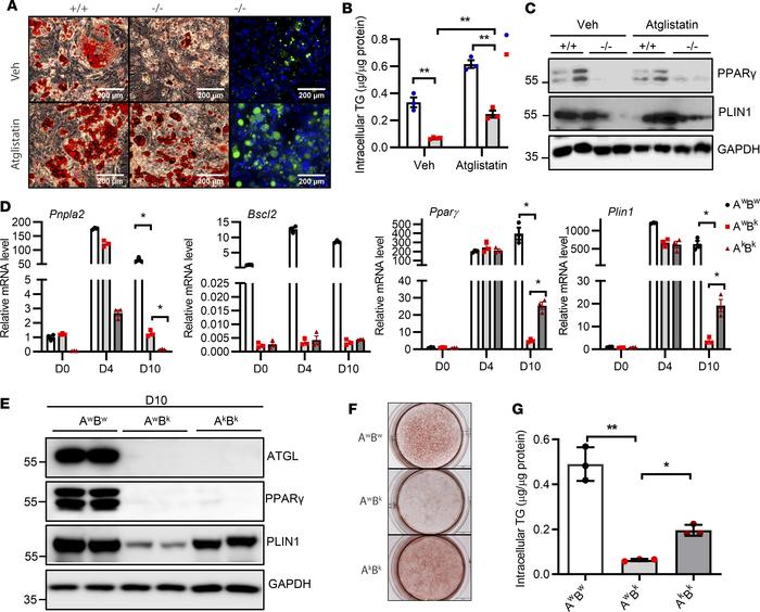 JCI Insight - Targeting ATGL to rescue BSCL2 lipodystrophy and its ...