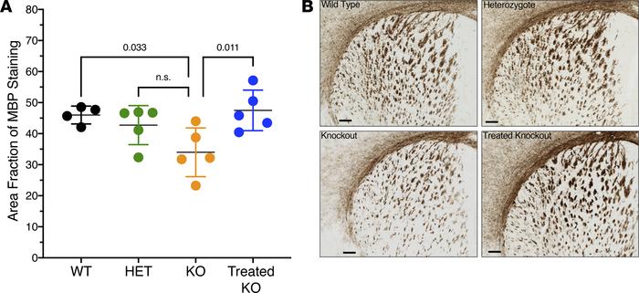JCI Insight - Hepatic arginase deficiency fosters dysmyelination during ...