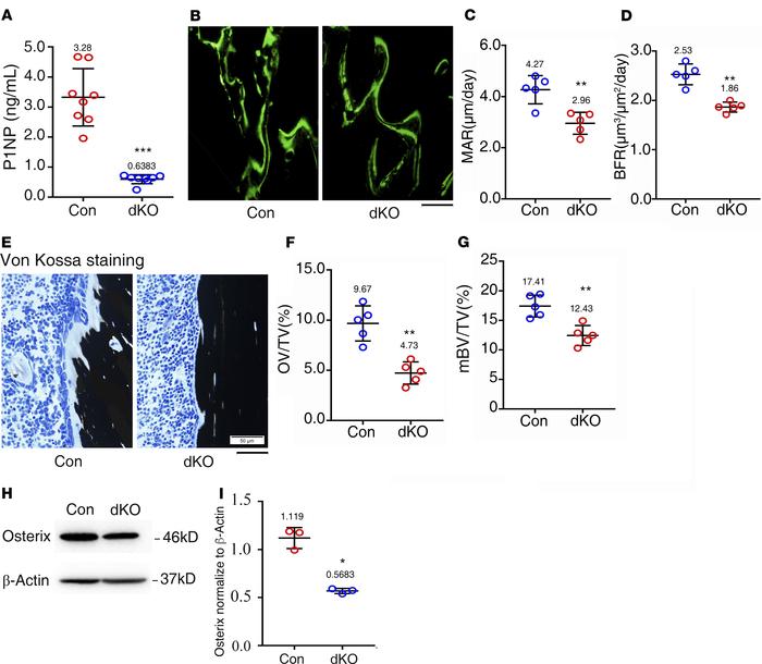 JCI Insight - Focal adhesion proteins Pinch1 and Pinch2 regulate bone ...