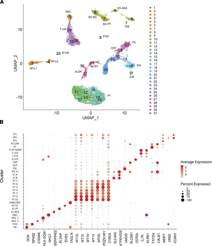 JCI Insight - Single cell transcriptomics identifies focal segmental ...