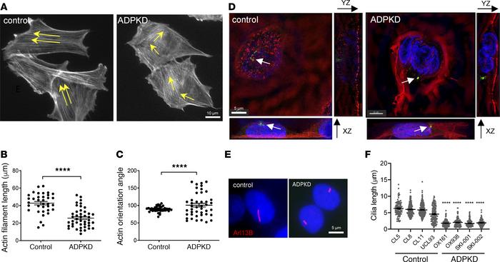 JCI Insight - Polycystin-1 regulates ARHGAP35-dependent centrosomal ...