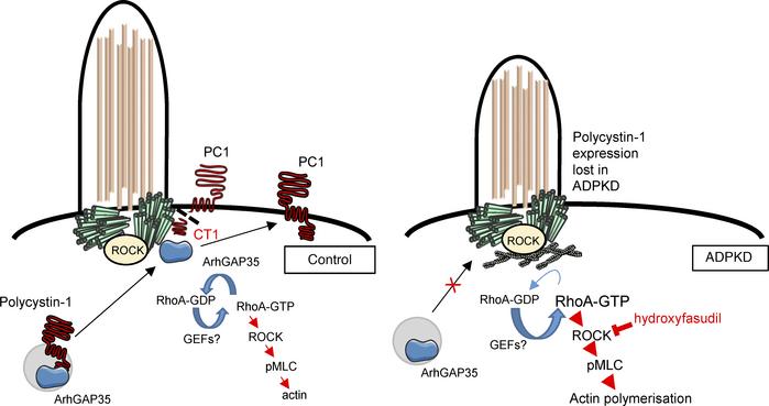 JCI Insight - Polycystin-1 regulates ARHGAP35-dependent centrosomal ...