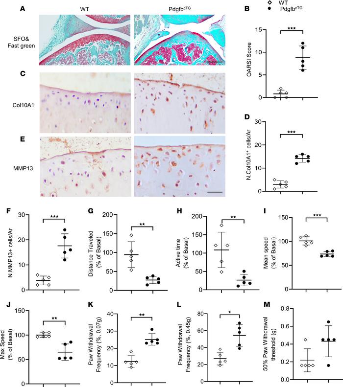 JCI Insight - Angiogenesis stimulated by elevated PDGF-BB in ...