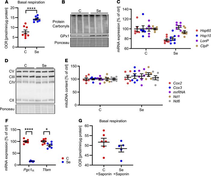 JCI Insight - GPx3 dysregulation impacts adipose tissue insulin ...