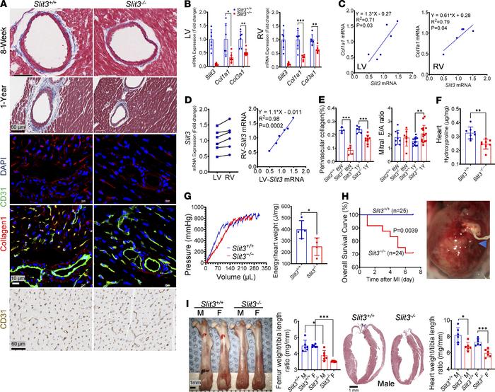 JCI Insight - SLIT3 deficiency attenuates pressure overload–induced ...