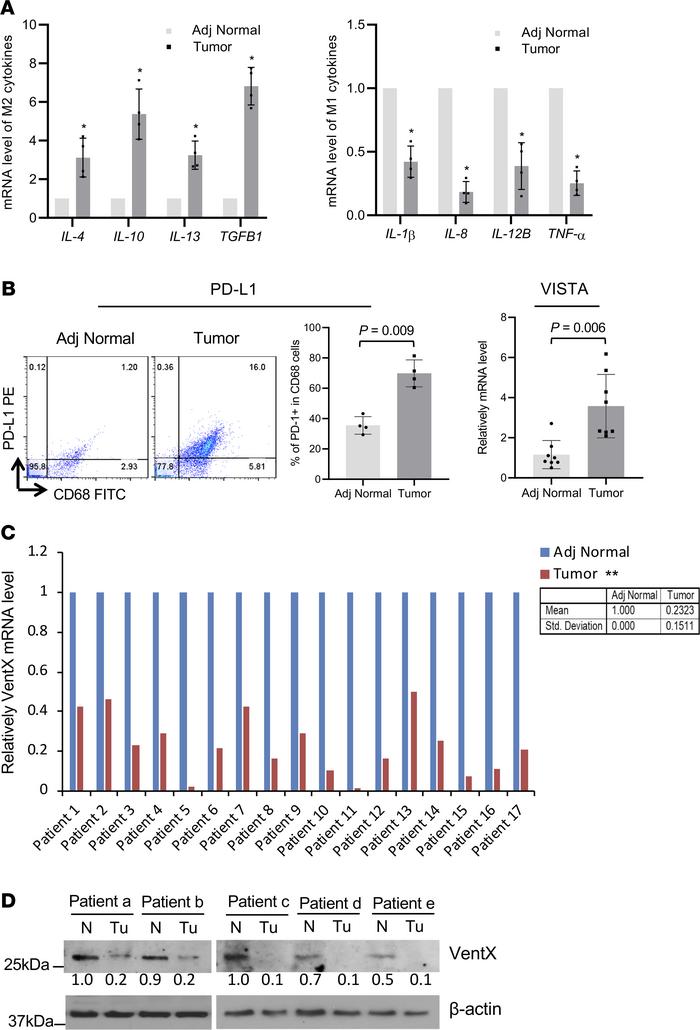 JCI Insight - VentX expression in tumor-associated macrophages promotes ...