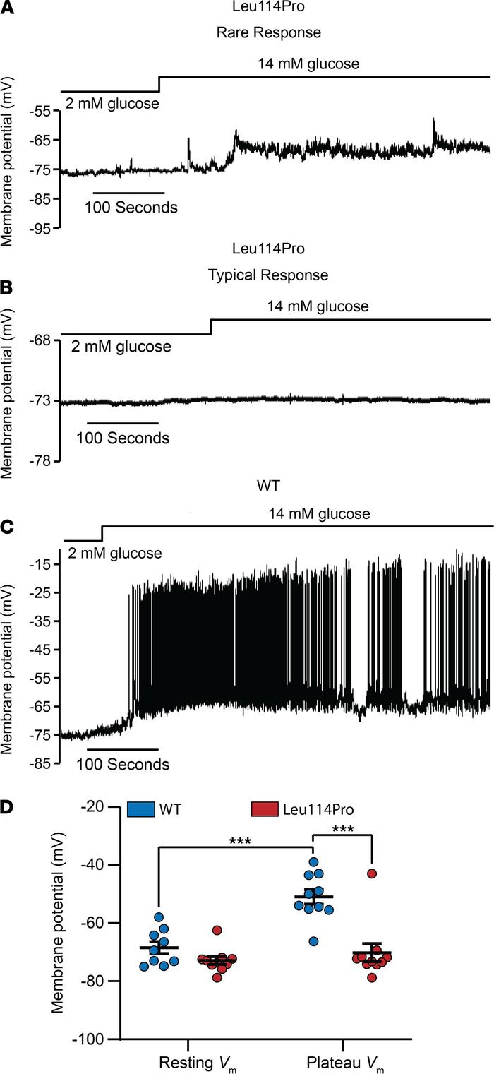 JCI Insight - A KCNK16 mutation causing TALK-1 gain of function is ...