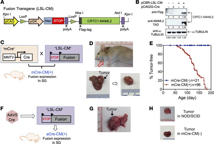 JCI Insight - The CRTC1-MAML2 fusion is the major oncogenic driver in ...