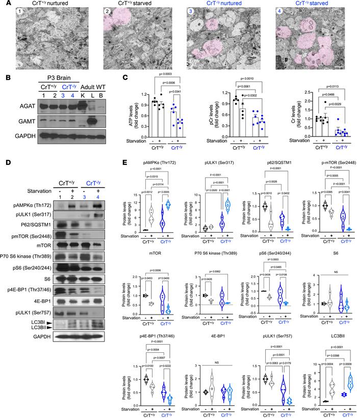 JCI Insight - Creatine transporter deficiency impairs stress adaptation ...