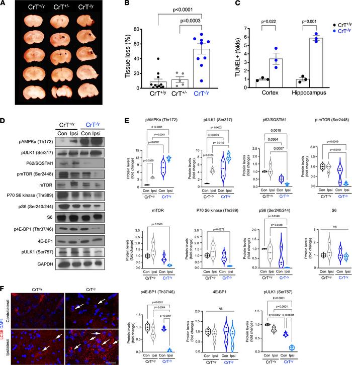 JCI Insight - Creatine transporter deficiency impairs stress adaptation ...