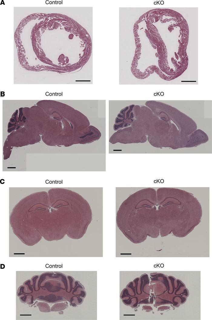 JCI Insight - Neural stem cell–specific ITPA deficiency causes neural ...