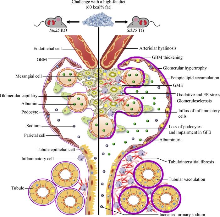 JCI Insight - Depletion of protein kinase STK25 ameliorates renal ...