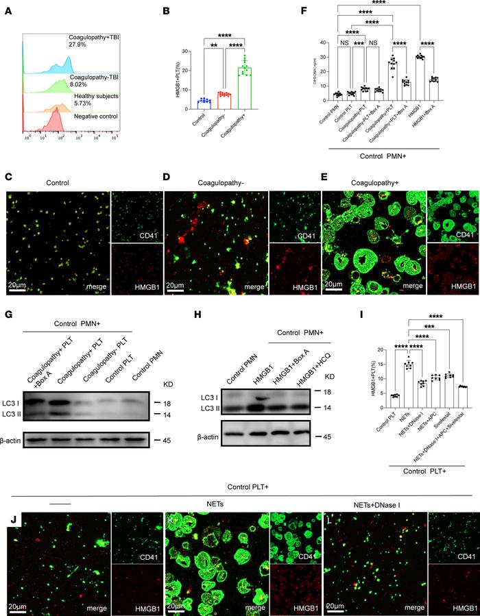 JCI Insight - Neutrophil extracellular traps contribute to coagulopathy ...