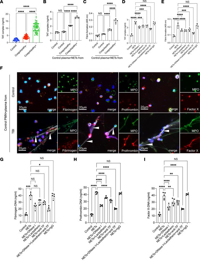 JCI Insight - Neutrophil extracellular traps contribute to coagulopathy ...