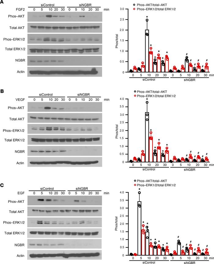 JCI Insight - NOGOB receptor–mediated RAS signaling pathway is a target ...