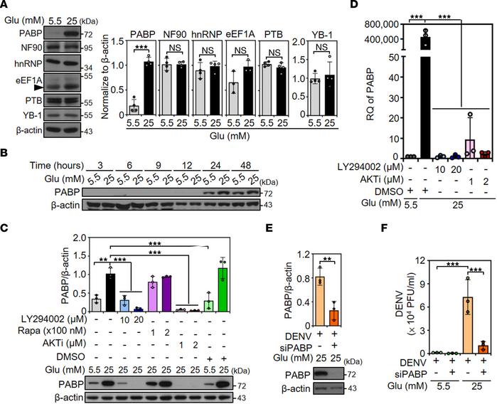 JCI Insight - Hyperglycemia exacerbates dengue virus infection by ...