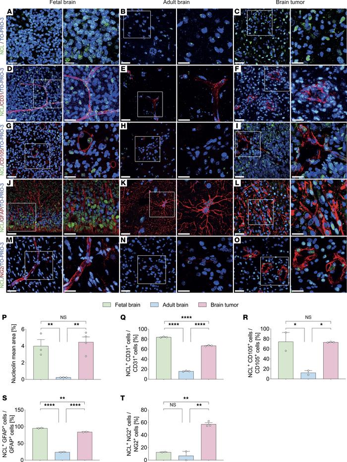 JCI Insight - Nucleolin promotes angiogenesis and endothelial ...
