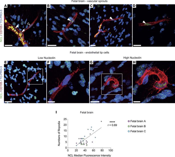 JCI Insight - Nucleolin promotes angiogenesis and endothelial ...