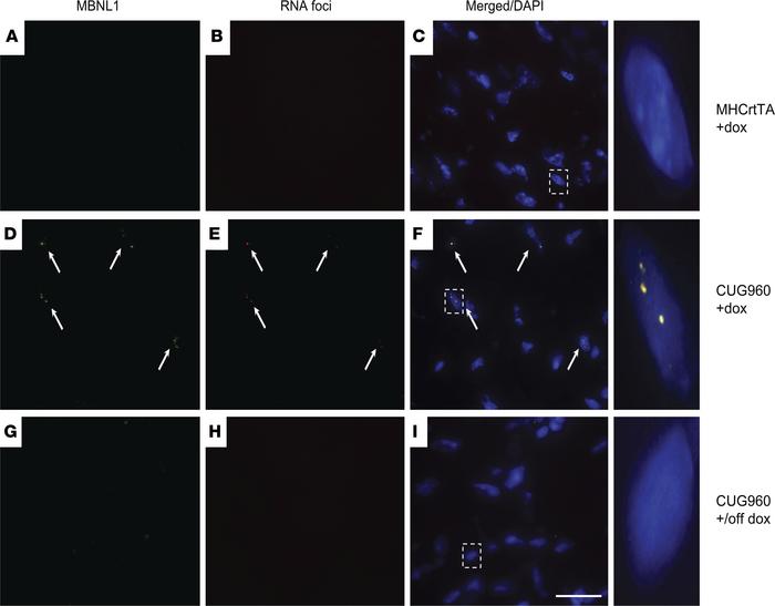 JCI Insight - Reversible cardiac disease features in an inducible CUG ...