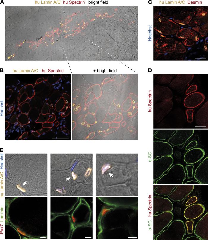 JCI Insight - Base editing repairs an SGCA mutation in human primary ...