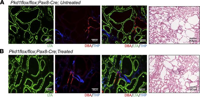 JCI Insight - Restoration of proximal tubule flow–activated transport ...