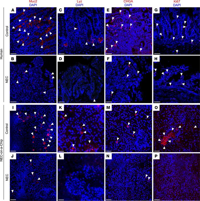 JCI Insight - Microfluidic device facilitates in vitro modeling of ...