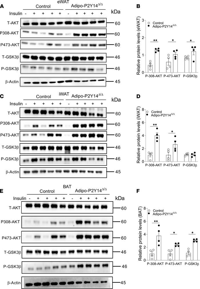JCI Insight - Adipocyte P2Y14 receptors play a key role in regulating ...