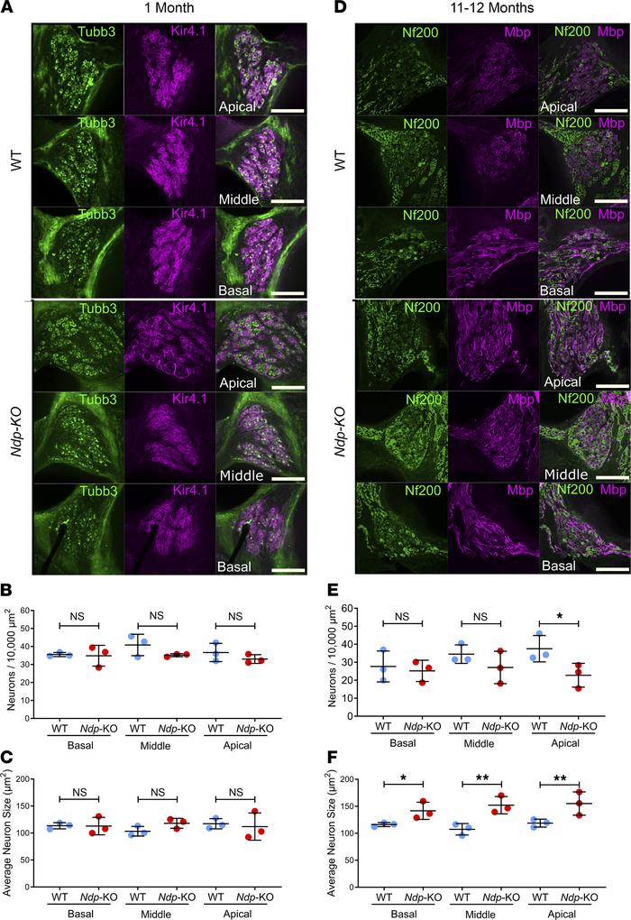 JCI Insight - The timing of auditory sensory deficits in Norrie disease ...