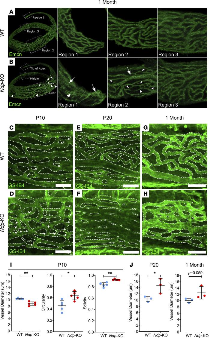 JCI Insight - The timing of auditory sensory deficits in Norrie disease ...
