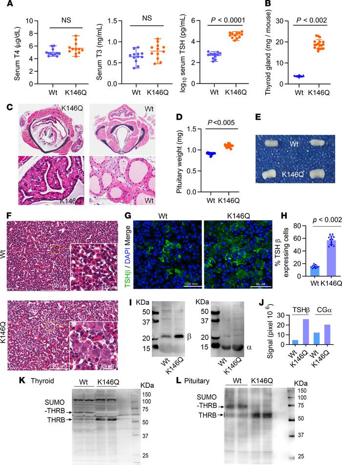 JCI Insight - Thyroid hormone receptor β sumoylation is required for ...